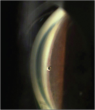 Glaucoma Physician | PentaVision