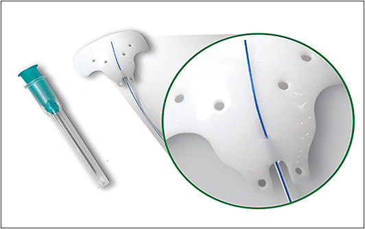 Glaucoma Physician | PentaVision