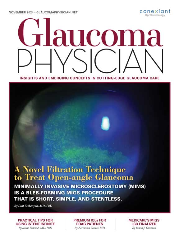 Medicare’s MIGS LCD Finalized | Glaucoma Physician