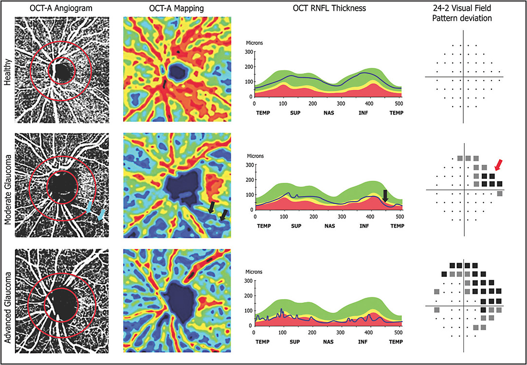 Glaucoma Physician | PentaVision